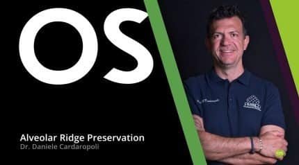 Alveolar Ridge Preservation - Dental Knowledge