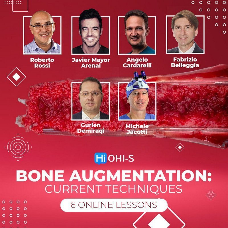 Bone Augmentation: Current Techniques Masterclass - Dental Knowledge