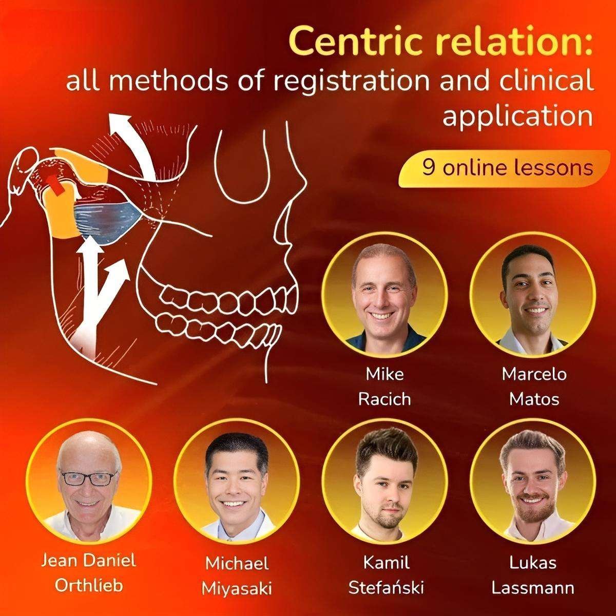 Centric Relation: All Methods of Registration and Clinical Application ...