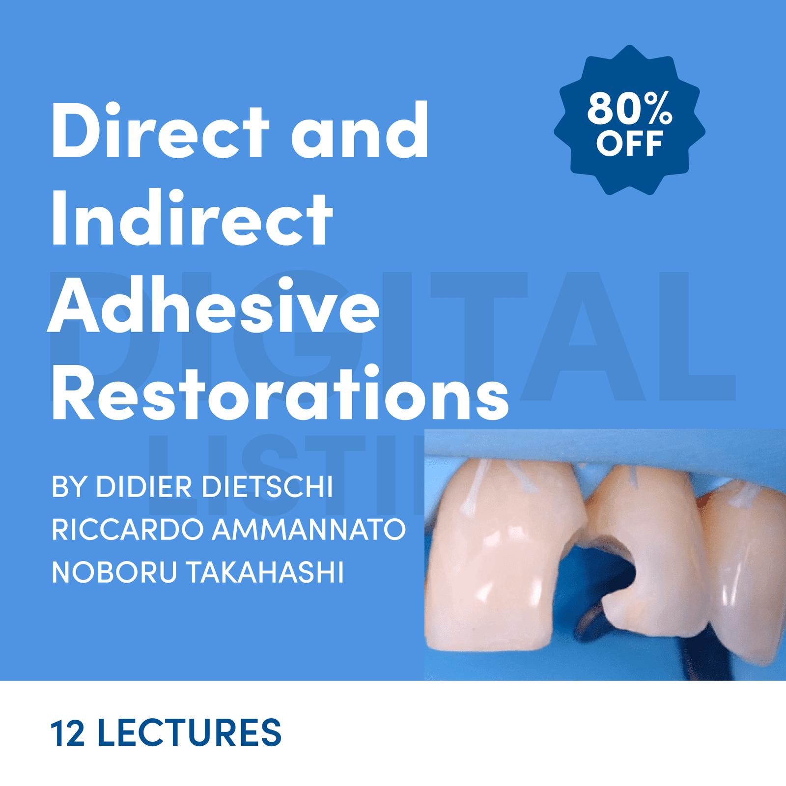 Direct and Indirect Adhesive Restorations - Dental Knowledge