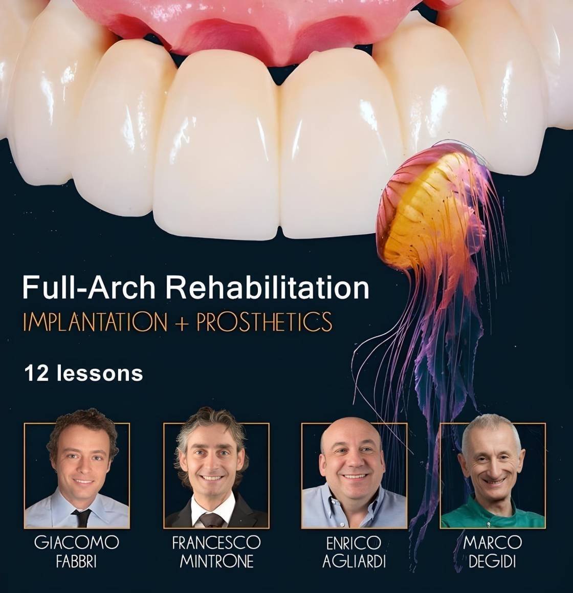 Full-Arch Rehabilitation: Implantation and Prosthetics - Dental Knowledge