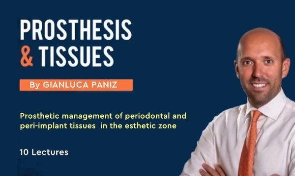 Prosthesis and Tissues (Prosthetic Management of Periodontal and Peri ...