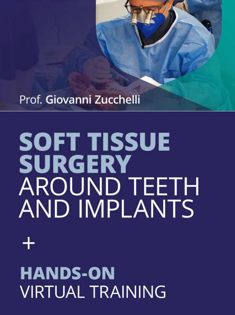 Soft tissue surgery around teeth and implants - Dental Knowledge